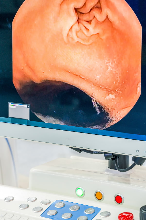 Capsule Endoscopy in Boise | Digestive Health Clinic